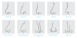 Most Common & Desired Nose Shapes | TPS