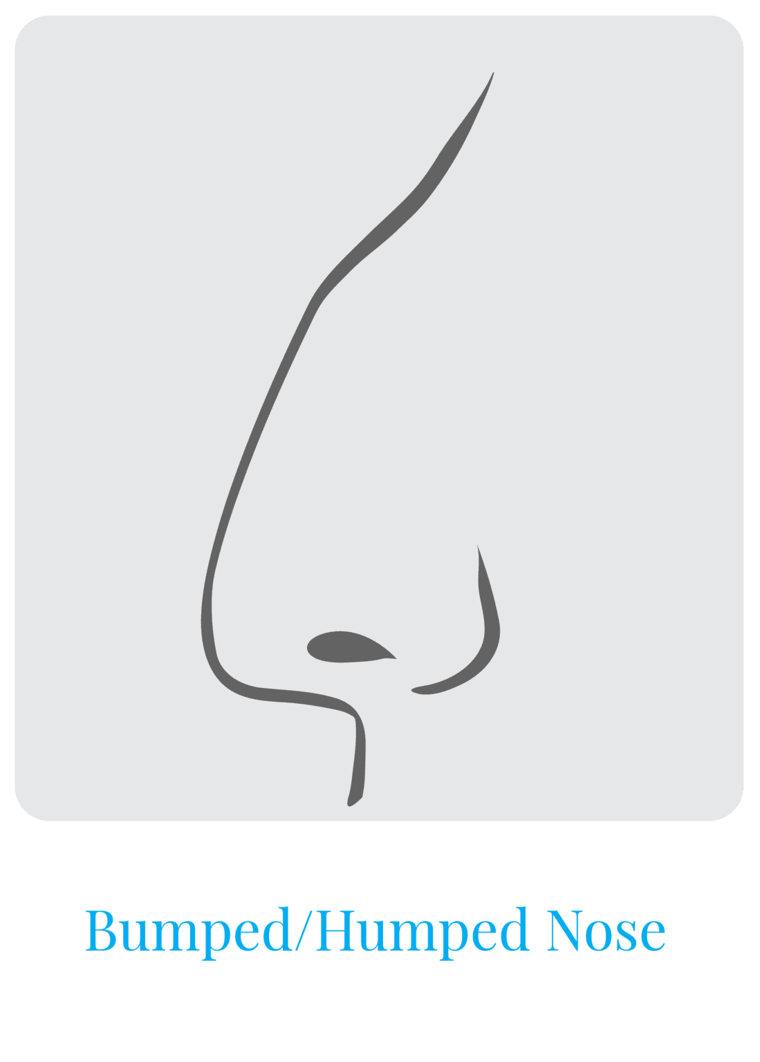 Most Common & Desired Nose Shapes | Toronto Plastic Surgeon Wellness Centre
