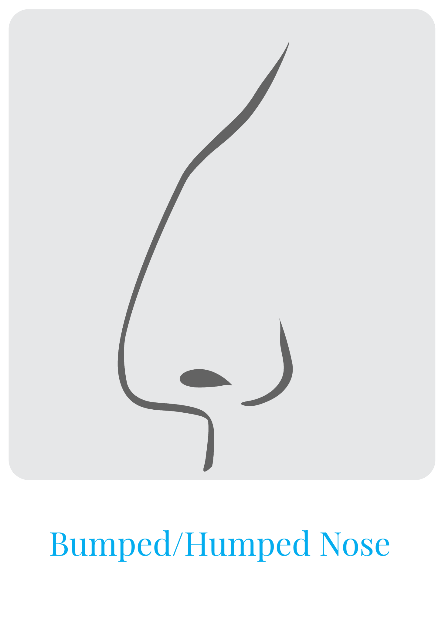 Most Common & Desired Nose Shapes | TPS