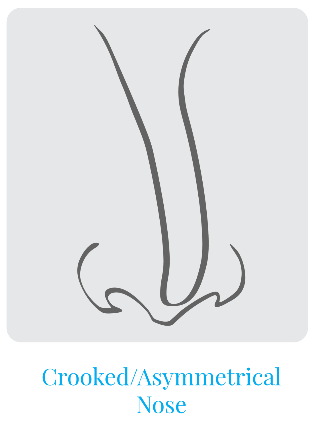 Most Common & Desired Nose Shapes | TPS