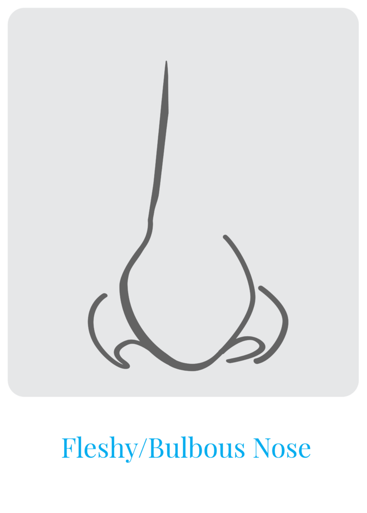 Most Common & Desired Nose Shapes | TPS