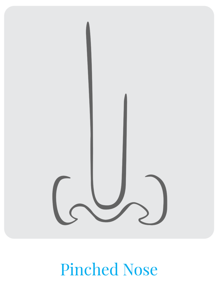 Most Common & Desired Nose Shapes | TPS