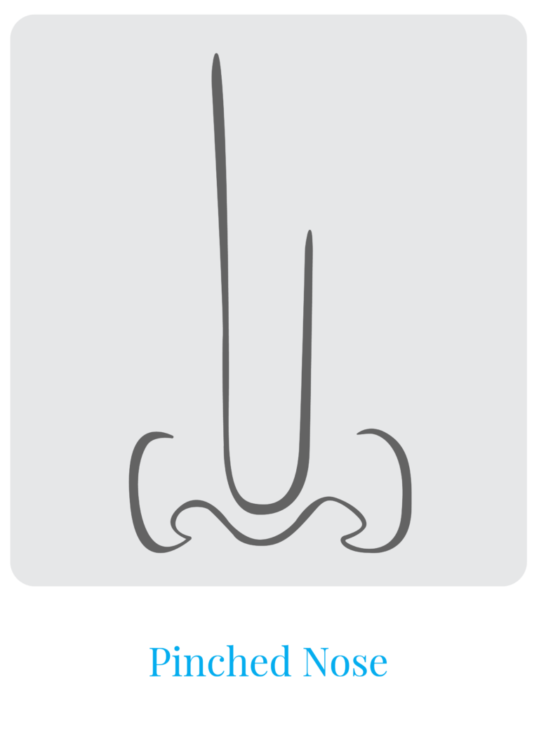 Most Common & Desired Nose Shapes | TPS