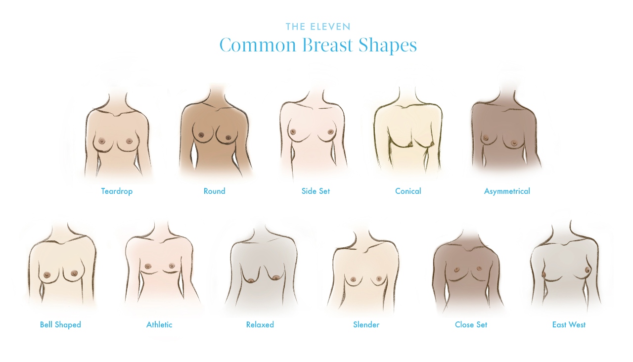 cone shaped breasts