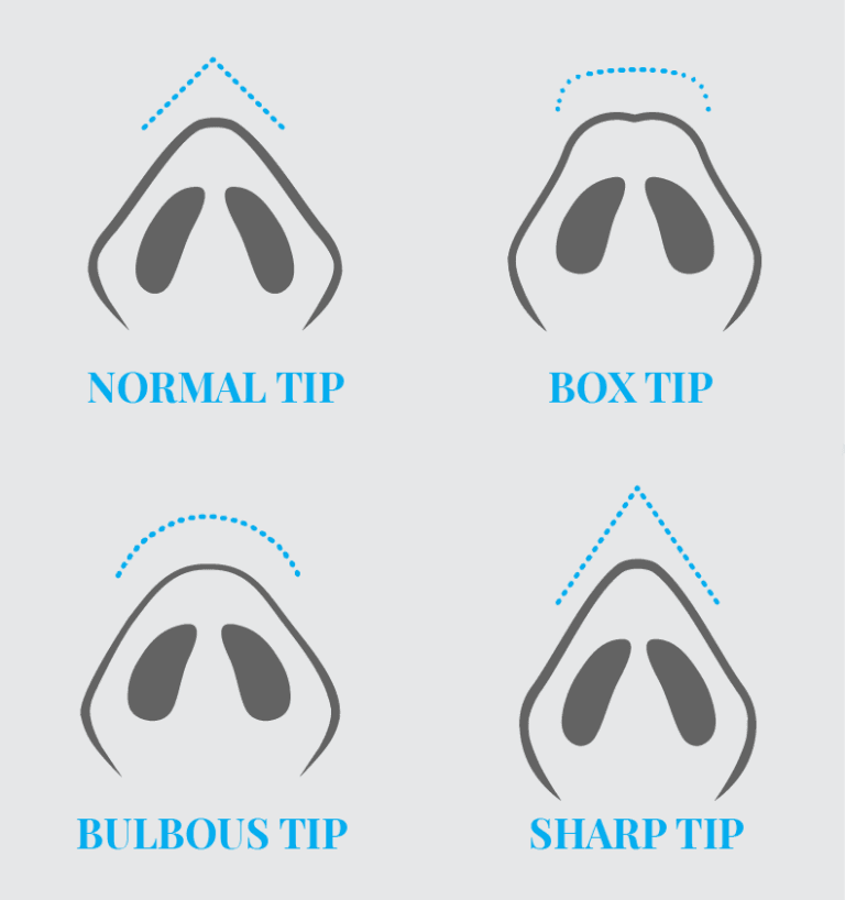 How to Fix and Narrow a Wide Nose | TPS